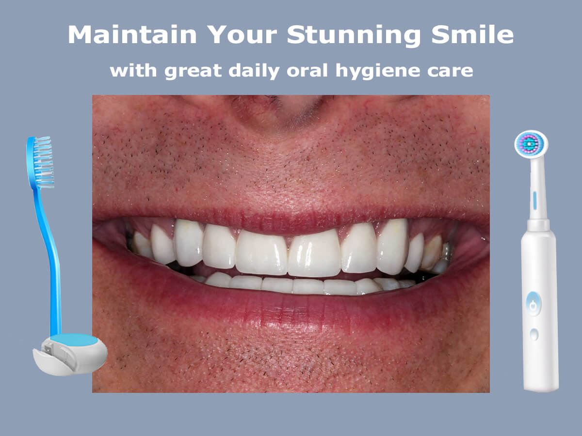 Adult Daily Oral Hygiene Care - Montgomery Dental Clinic